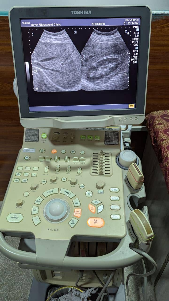 Toshiba Altrasound Machine - Ultrasound Machines - 1106305085