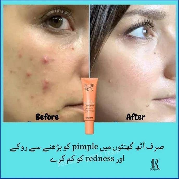 pure skin sos blemish gel - Skin Care - 1110992281